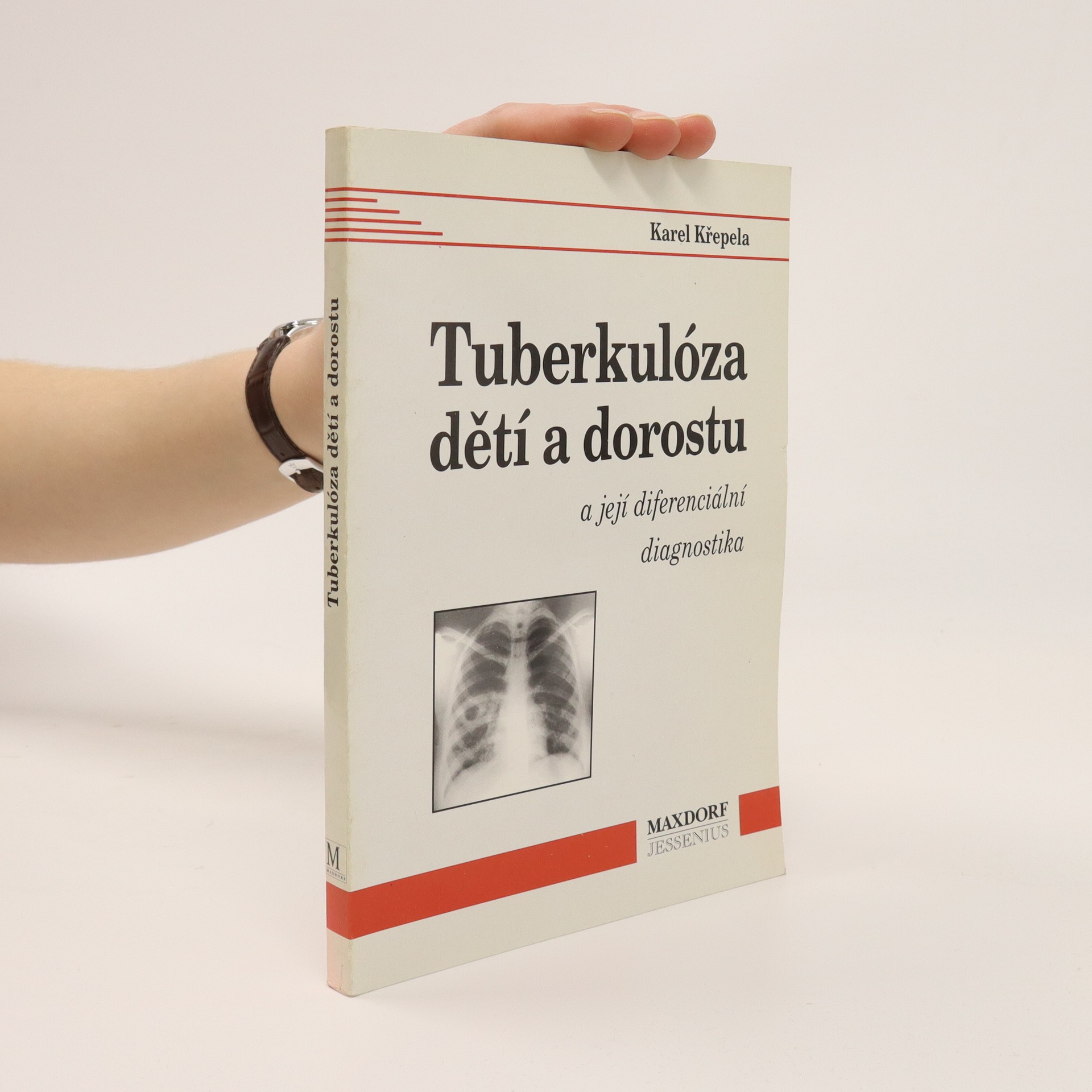 Tuberkulóza dětí a dorostu a její diferenciální diagnostika - Karel ...